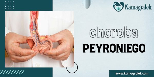 choroba peyroniego - kamagralek.com